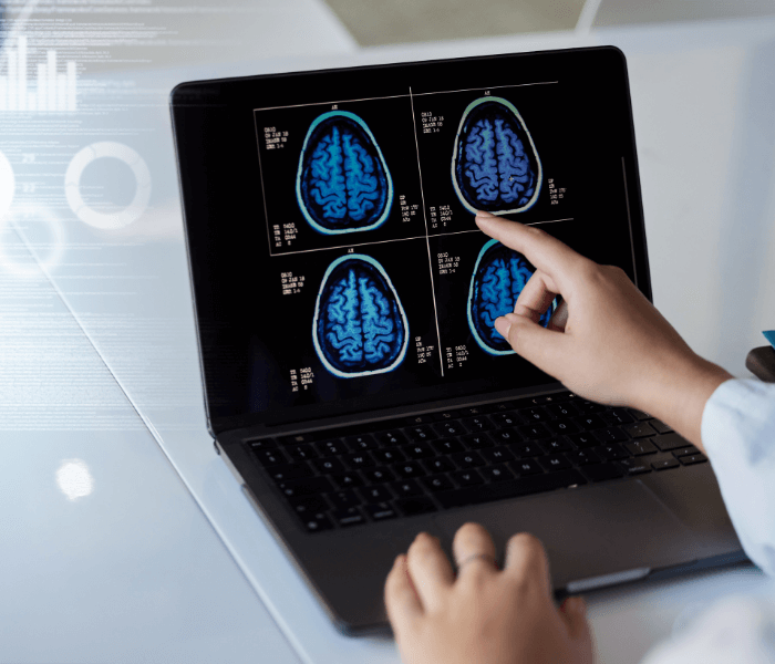 Pediatric Neurologist in Gurgaon